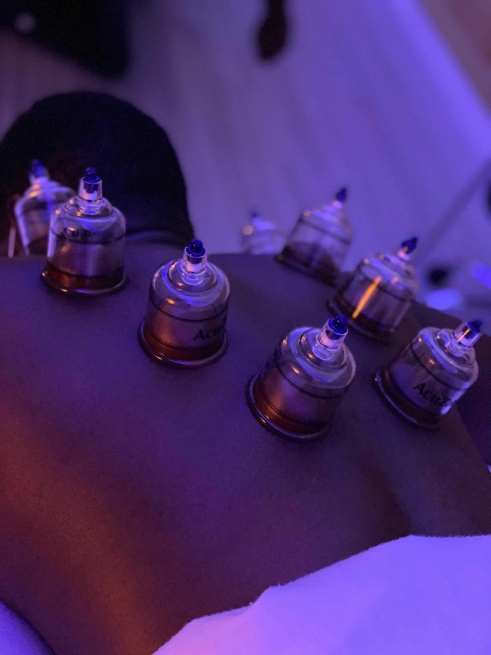 Cupping Therapy: What is It, How it Works, Benefits, and More - Muscle Lab